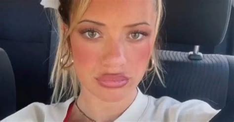 Tilly Whitfield Warns Against Following Trends After Another Beauty Treatment Goes Wrong Daily