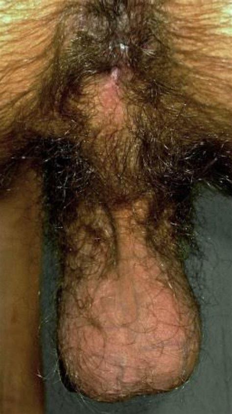 Hairy Ass Balls Tubbys1st