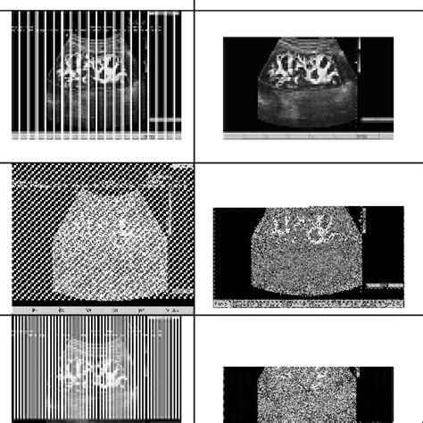 pdf medical image watermarking with tamper detection and recovery