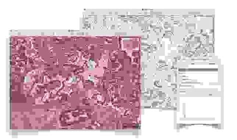 introduction to digital pathology using qupath
