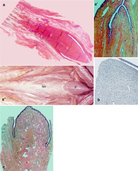External Morphology Of The Clitoris SpringerLink