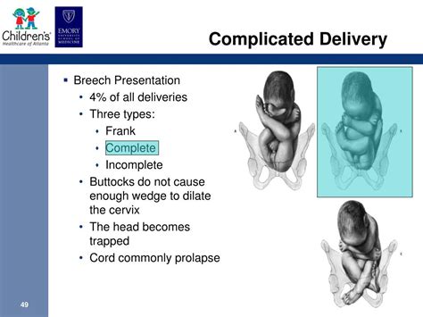 Ppt Labor And Delivery In The Emergency Department Powerpoint Presentation Id1473835