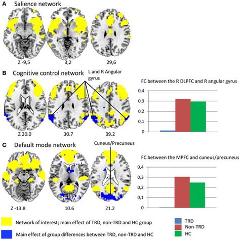 differences in resting state functional connectivity between treatment download scientific