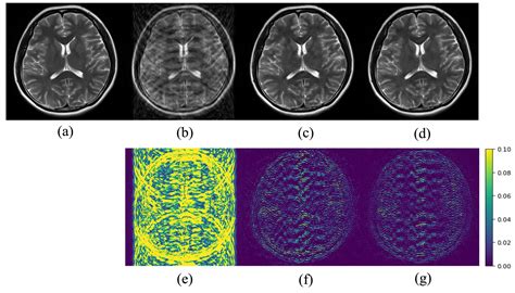 sensors free full text reference driven compressed sensing mr image reconstruction using