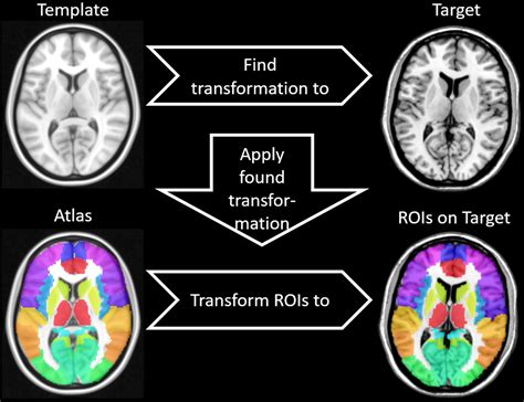 image segmentation and nonuniformity correction methods clinical tree