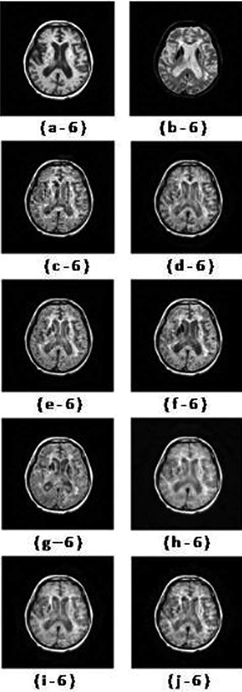 fused image using different fusion methods of case 6 a‐6 discrete download scientific