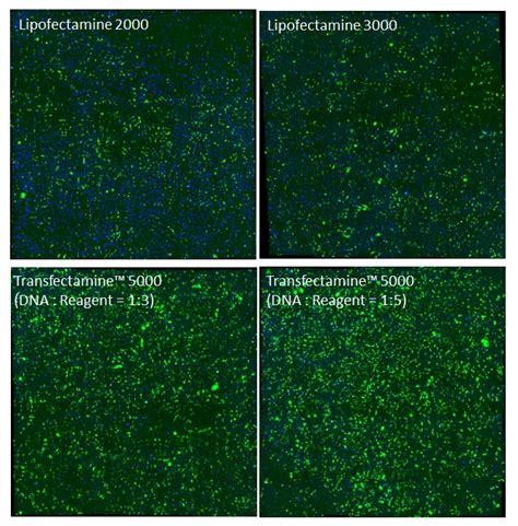 Transfectamine 5000 Transfection Reagent AAT Bioquest