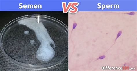 Semen Vs Sperm Key Differences And Faq ~ Difference 101