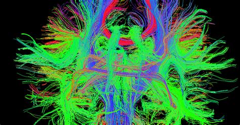 diffusion tensor imaging 101 diffusion imaging introduction tutorials and background on