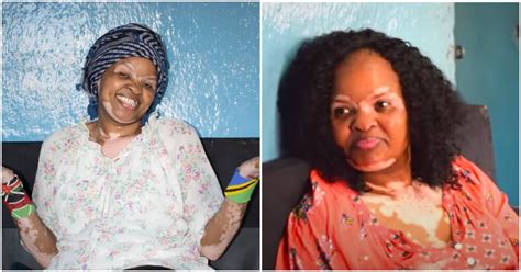 Ex Machachari Actress Mama Stella Says Says She Is Not Getting Acting Jobs Due To Her Vitiligo