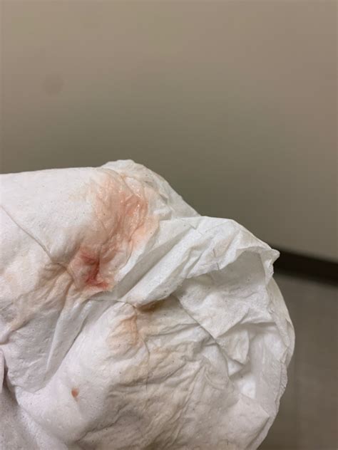 Implantation Bleeding Glow Community