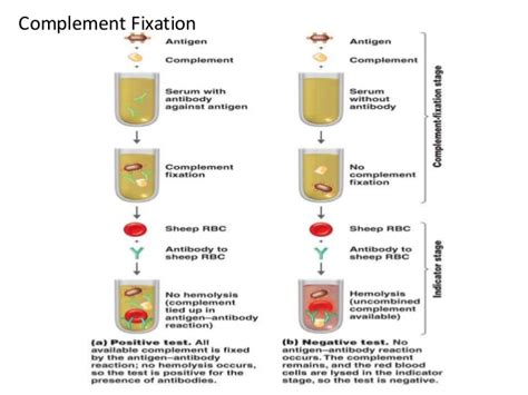 complement fixation test principle procedure result interpretation applications and