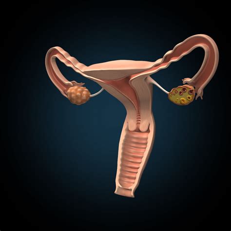 3d Female Uterus Model