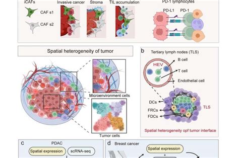Exploring Spatial Transcriptomics In Biomedical Research
