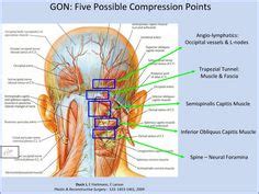 Decompression Occipital Nerve Decompression Surgery