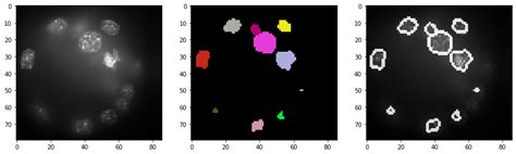 3d image segmentation — image data science with python and napari epfl