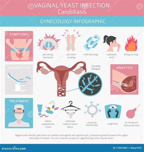 Vaginal Yeast Infection Candidiasis Stock Vector Illustration Of Germs Dysbiosis 119874987