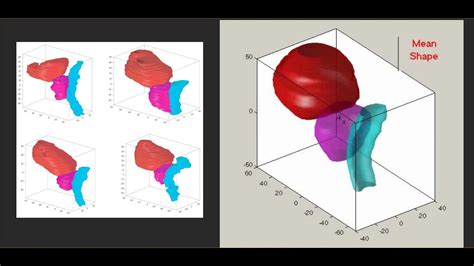 dip lecture 25 active shape models youtube