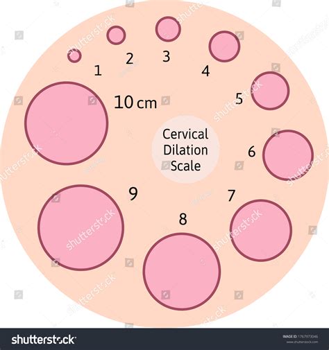 Cervix Dilation Chart Signs Stages And Procedure To Check