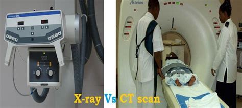 Difference Between X Ray And CT Scan With Comparison Chart Bio