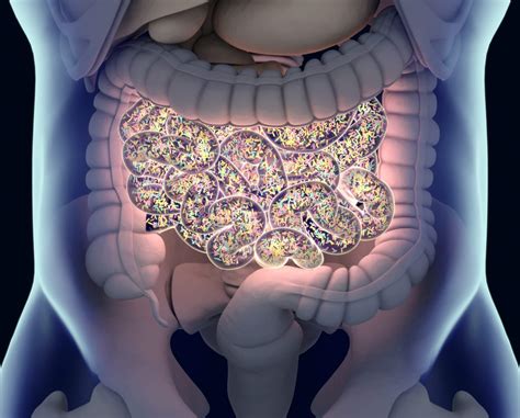 Colorectal Cancer And The Gut Microbiome What Are The Connections Infectious Disease Advisor