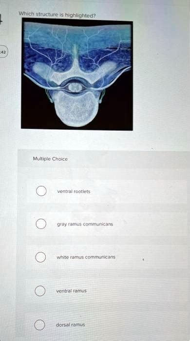 Solved Which Structure Is Highlighted Multiple Choice Ventral