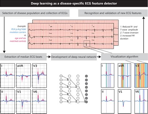 discovering and visualizing disease specific electrocardiogram features using deep learning