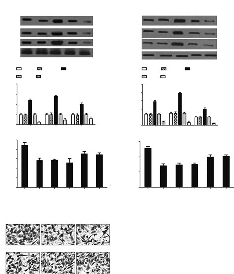 Wnt β catenin and JAK2 STAT3 signaling pathways took part in regulating