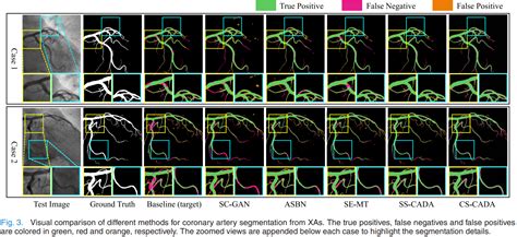 【tmi2023】contrastive semi supervised learning for domain adaptive segmentation across similar