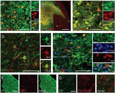 Neuronal Phenotypes Of Grafted FA IPS Neural Progenitors A The
