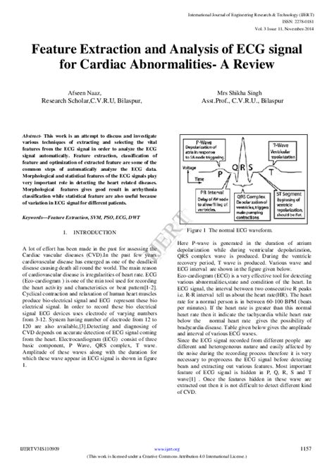 pdf ijert feature extraction and analysis of ecg signal for cardiac abnormalities a review