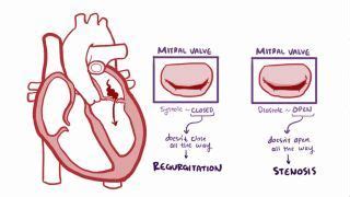 Heart Valve Diseases Notes Diagrams Illustrations Osmosis