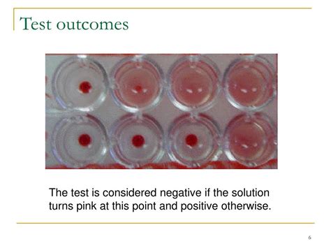 ppt complement fixation test powerpoint presentation free download id 660946