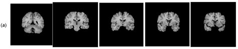 computers free full text enhancing brain segmentation in mri through integration of hidden