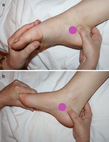 Lateral Plantar Nerve Entrapment WikiMSK