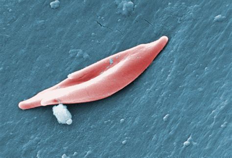 Public Domain Picture This Digitally Colorized Scanning Electron
