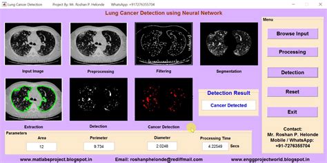 lung cancer detection using neural network matlab project source code ~ matlab projects