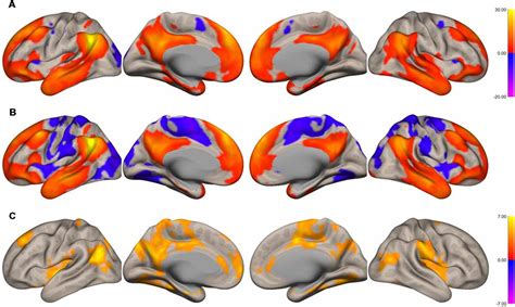 Frontiers Increased Functional Connectivity Of The Angular Gyrus
