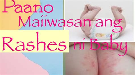 Gamot Sa Rashes Ng Baby