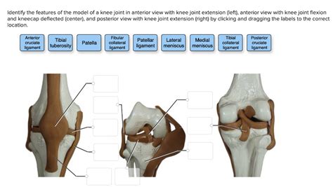 Solved Identify The Features Of The Model Of A Knee Joint In Chegg