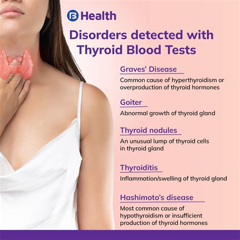How To Check For Thyroid Disease Bathmost9