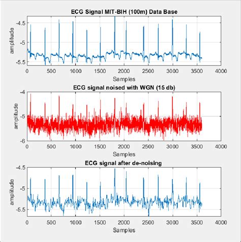 represent the ecg signal the noisy signal and the denoise signal download scientific diagram