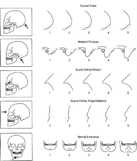 figure 1 from sexing skulls using discriminant function analysis of visually assessed traits