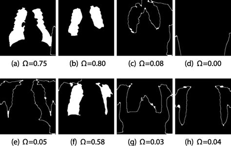 the effect of otsu with basic contrast enhancement and histogram download scientific diagram
