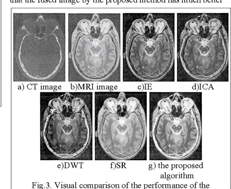 figure 2 from medical image feature extraction and fusion algorithm based on k svd semantic