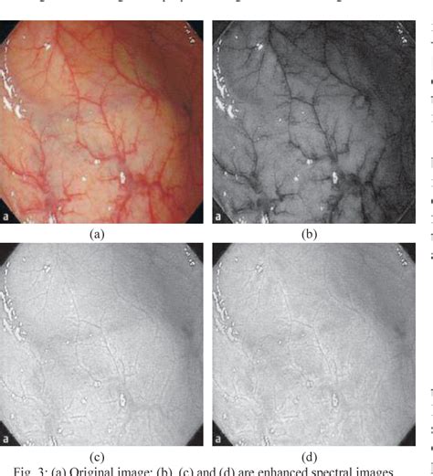 figure 3 from a color reproduction method with image enhancement for endoscopic images