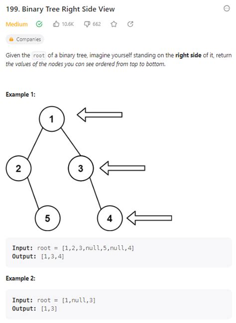 1스4코2파 208 LeetCode 199 Binary Tree Right Side View