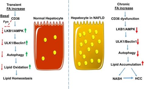 Regulation Of Lipophagy In NAFLD By Cellular Metabolism And CD361