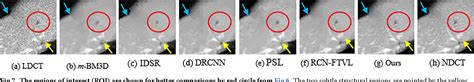 figure 7 from a constructive non local means algorithm for low dose computed tomography