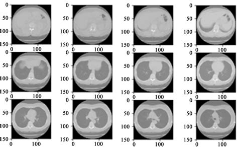 lung cancer detection using ct image based on 3d convolutional neural network